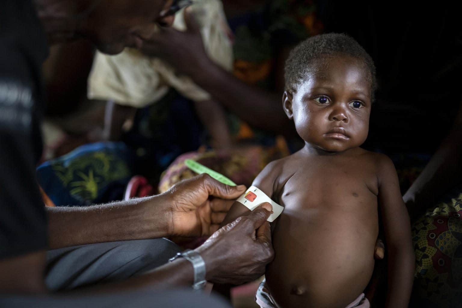 Malnutrition infantile et alimentation des enfants - UNICEF