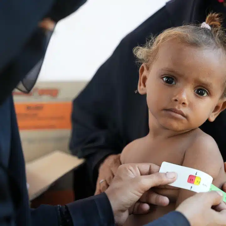 Malnutrition infantile et alimentation des enfants - UNICEF Malnutrition infantile et alimentation des enfants - UNICEF